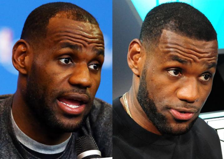 LeBosley James? LeBron hairline moves forward.